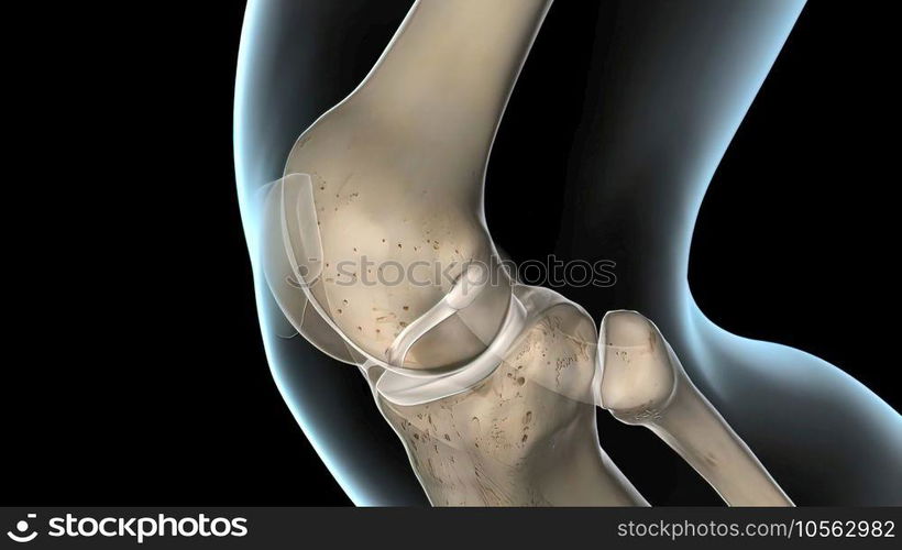 anterior cruciate ligament, the knee joint 3D Render. anterior cruciate ...