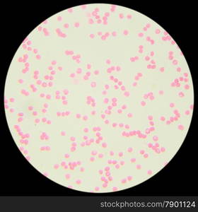 Chicken red blood cells under a microscope (blood smear Chicken), 400x ...