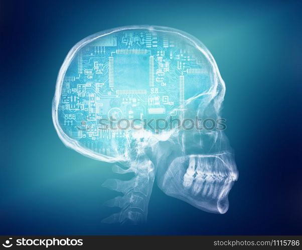 Human skull X-ray image. Artificial intelligence futuristic concept ...